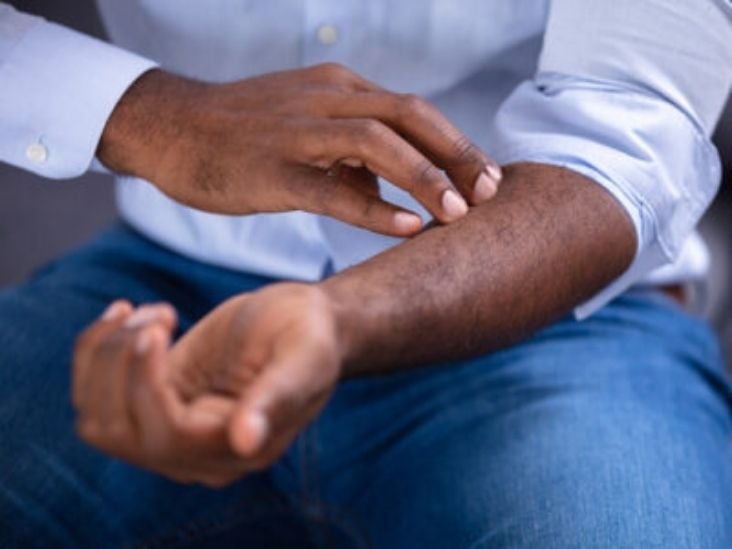 Why Does Psoriasis Itch and How to Remedy It