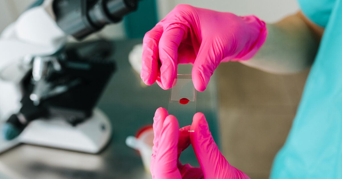 Ham Test: Purpose, Procedure and Results