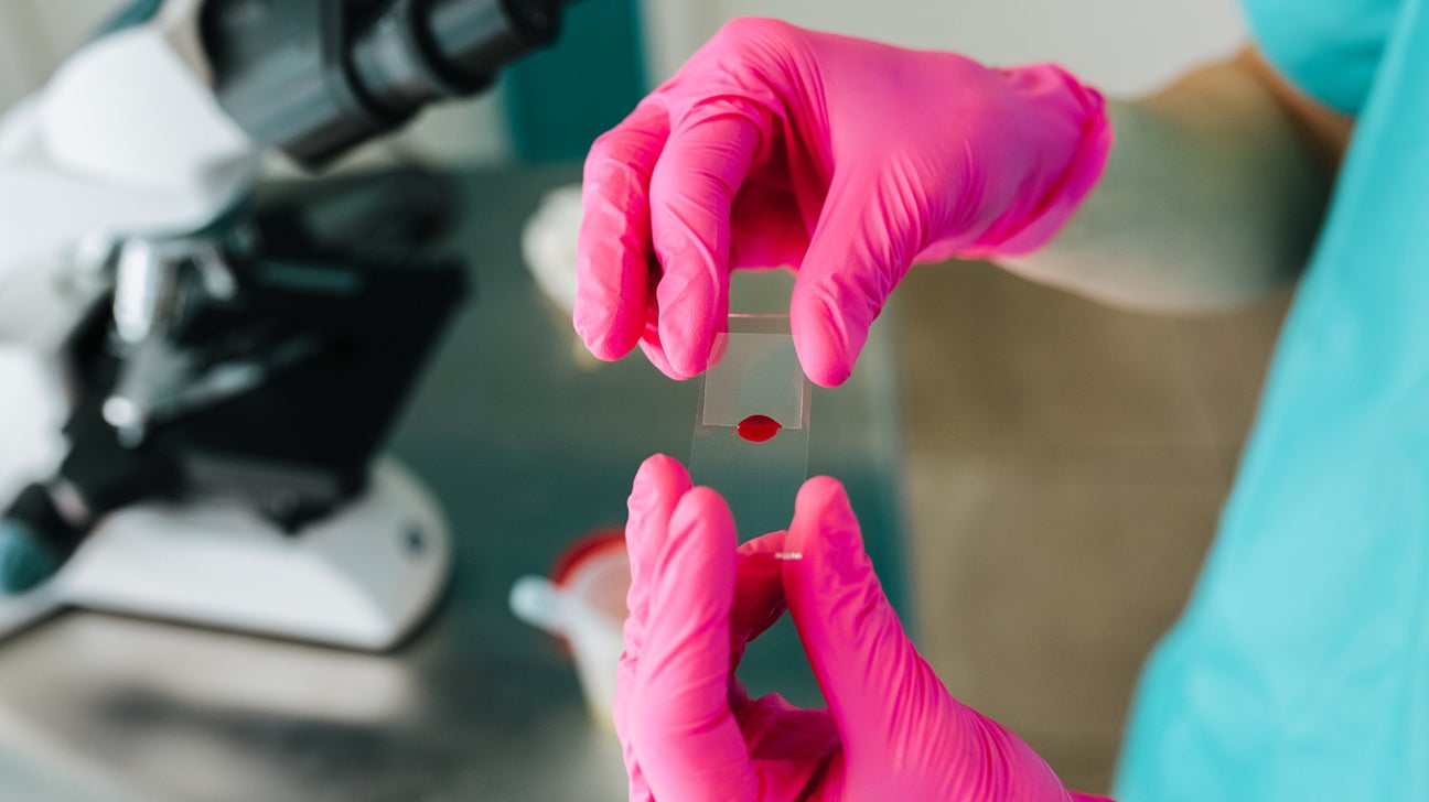 Ham Test: Purpose, Procedure and Results