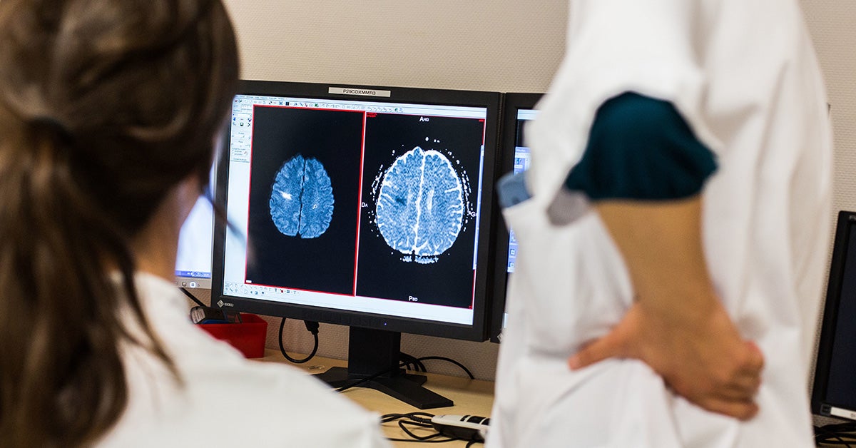 Thrombotic Stroke Vs Embolic Symptoms Treatment And More