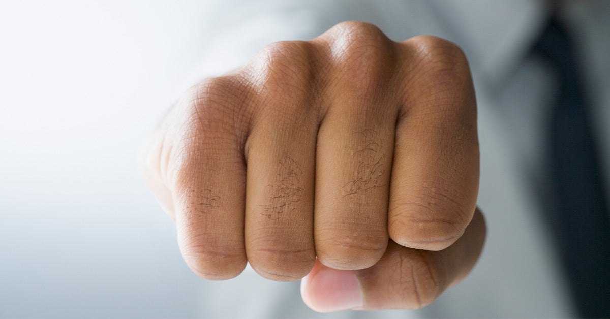 Why Some Have Knuckle Hair And How To Remove It Why Some Have Knuckle Hair And How To Remove It