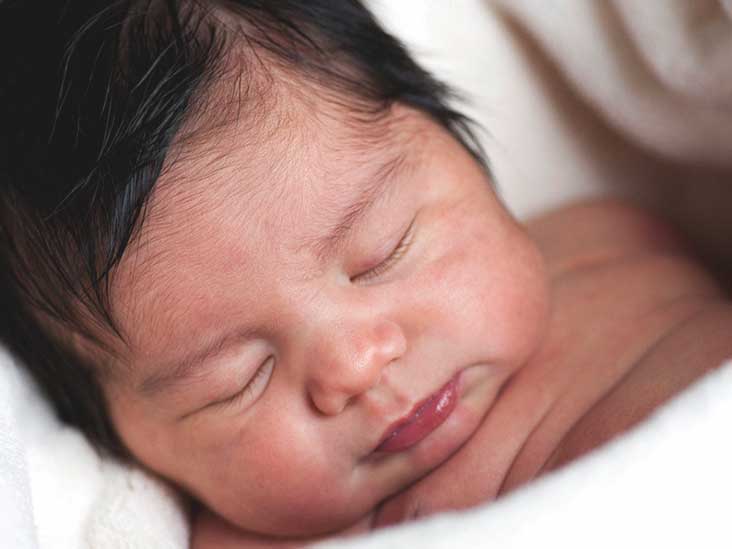 Lanugo Causes And Treatment