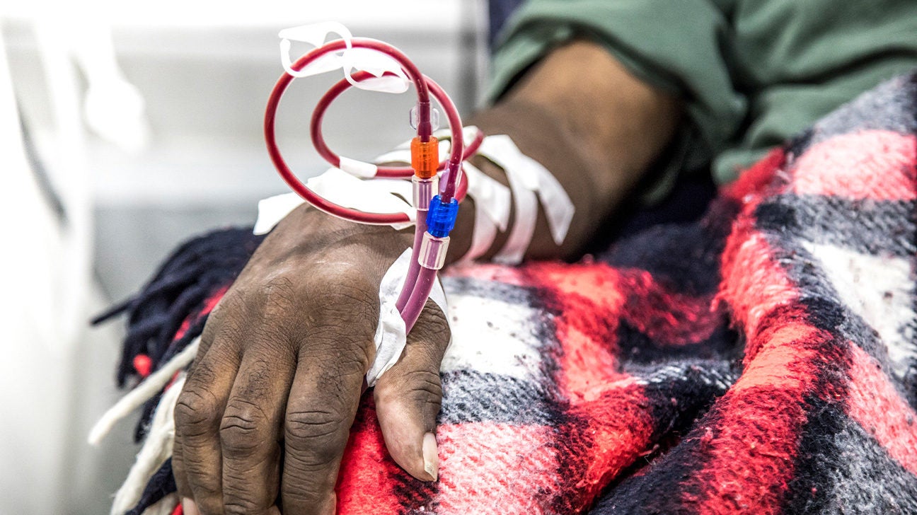 Understanding Dialysis Side Effects