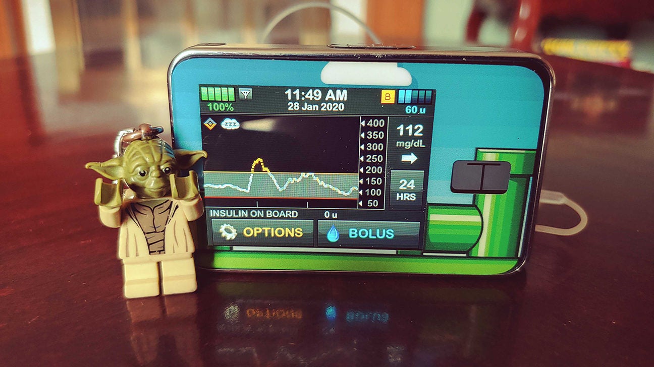 Product Review: Tandem Diabetes Control-IQ | DiabetesMine