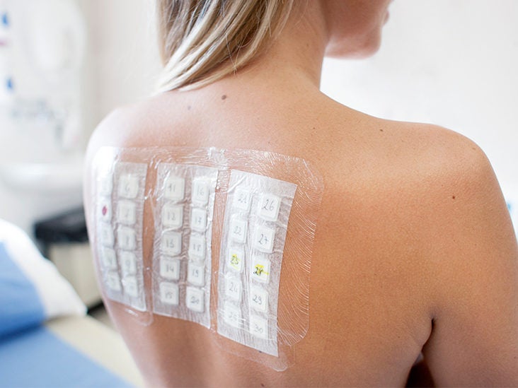 Allergy Testing Near Me Uk What Is Near Me