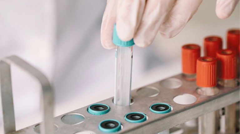 Does Medicare Cover Blood Tests does-medicare-cover-blood-tests