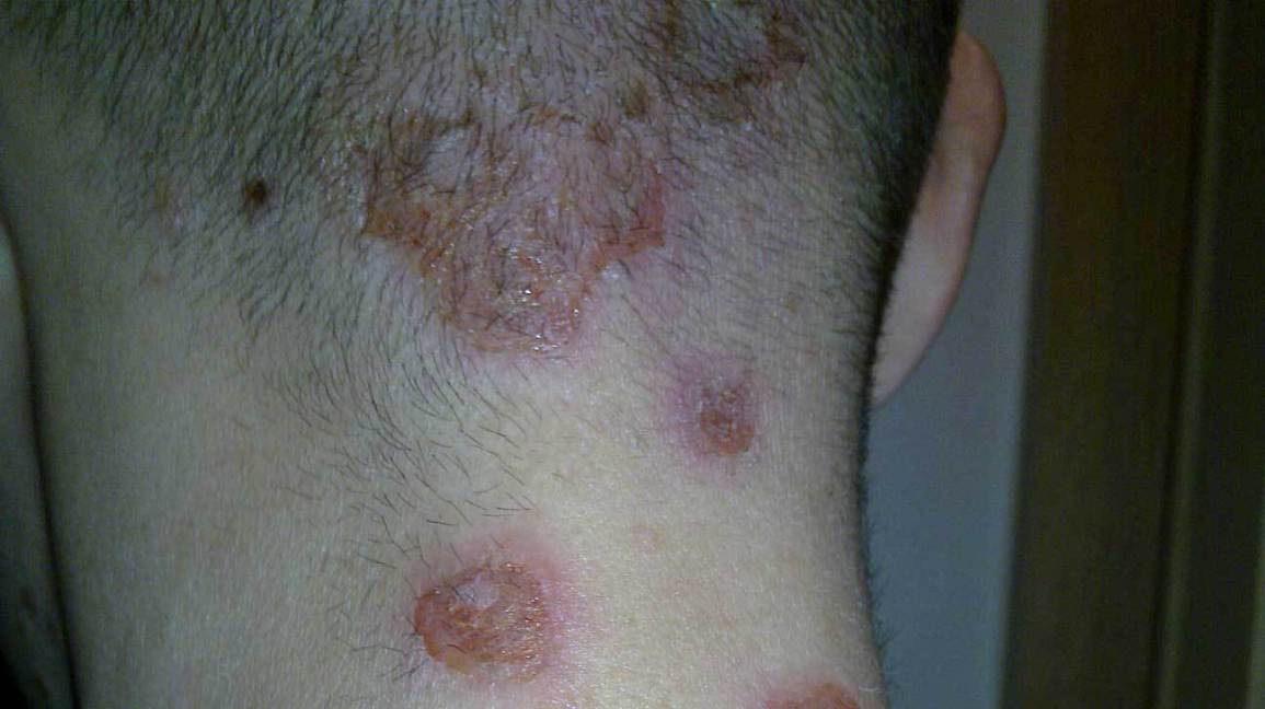 Problemas de la piel: fotos, causas, síntomas y tratamientos