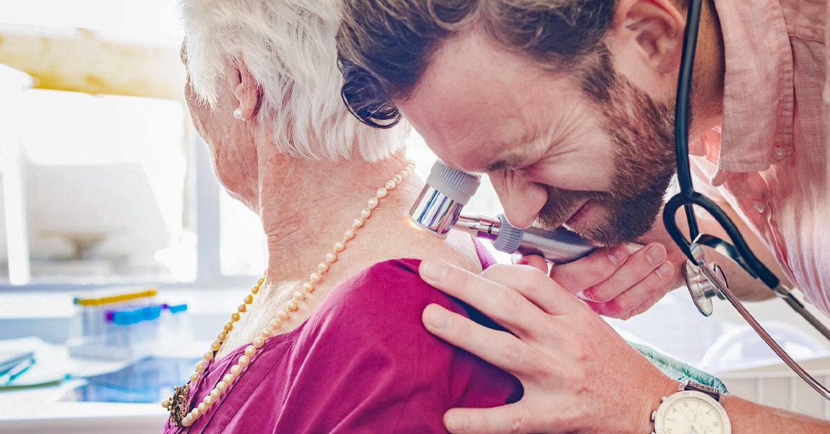 Rodent Ulcer: Another Name for Basal Cell Carcinoma