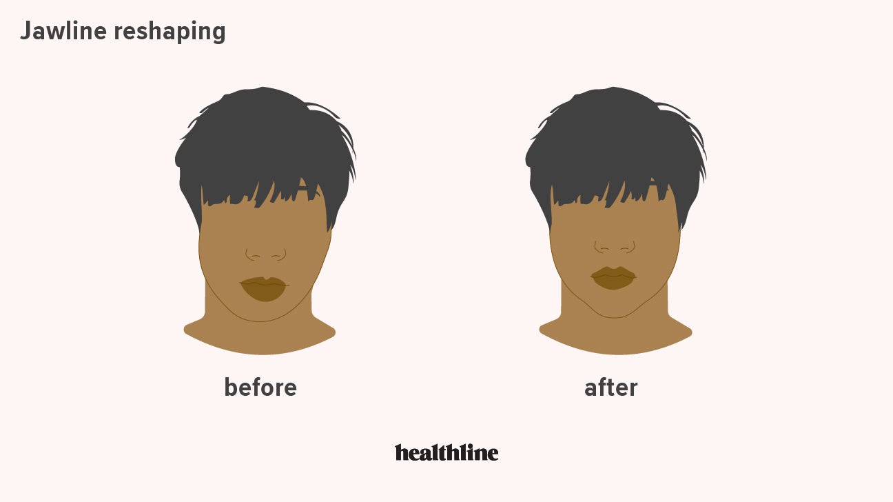 How To Make Jawline Sharper Shop Online Ids deutschland de