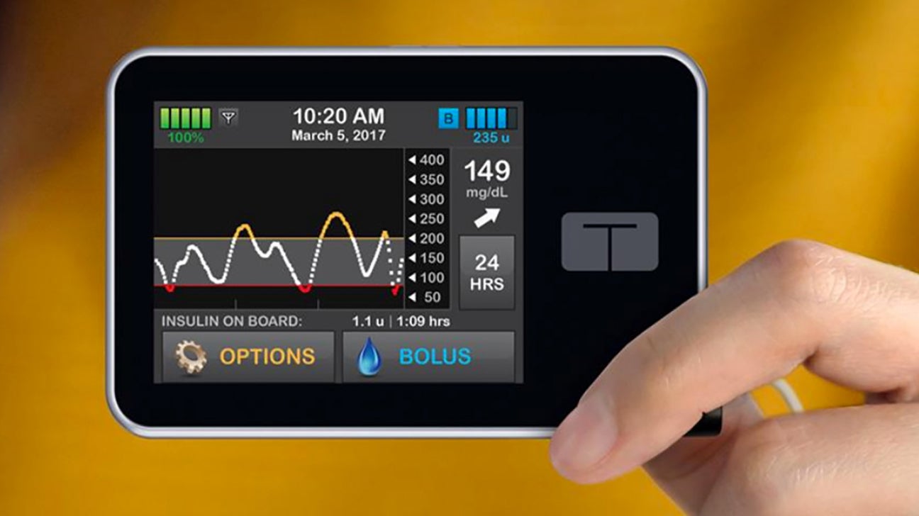 A Guide to Insulin Pumps and New Diabetes Technology | DiabetesMine