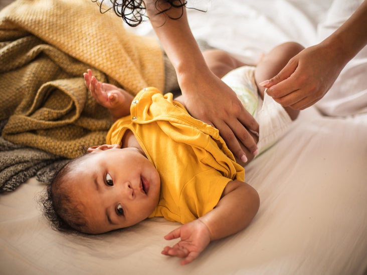 Baby Diarrhea Causes Treatments And When To Worry