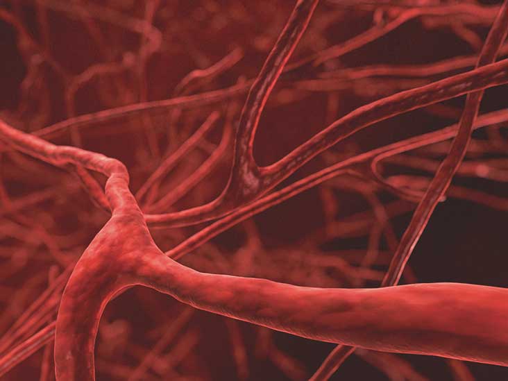 Takayasu’s Arteritis: Symptoms, Types, Treatment, and More