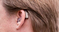 Hearing Loss: Causes, Symptoms and Prevention