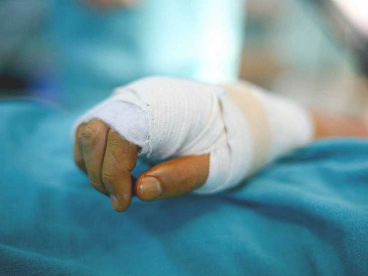 Degloving Images Types Treatment And Complications