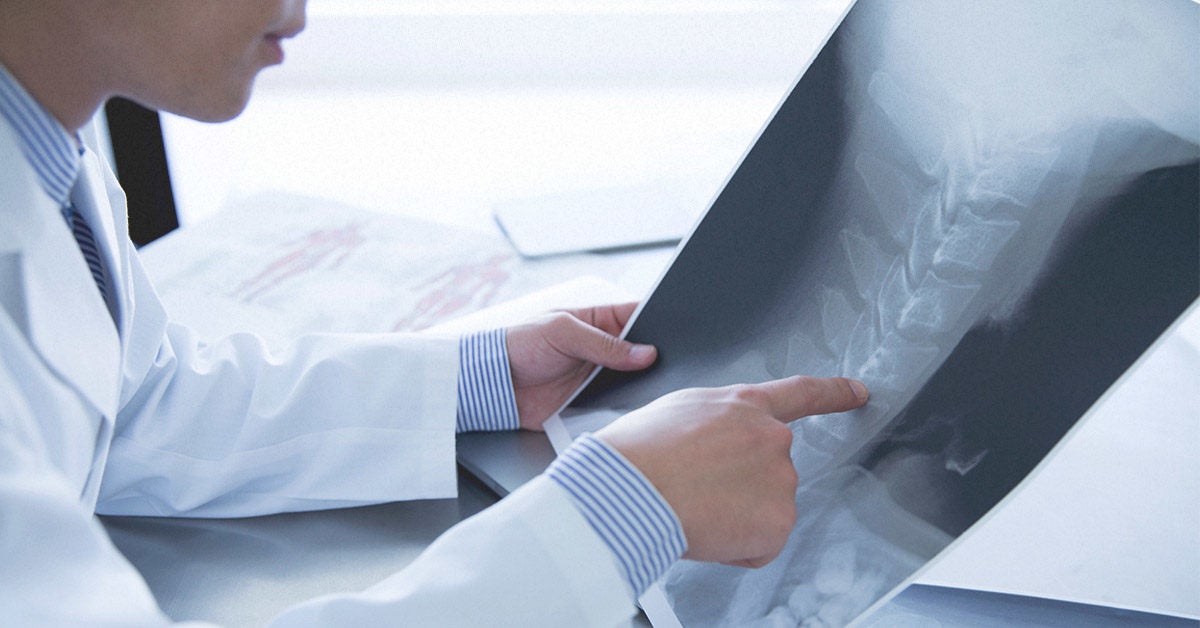 Scrofula: Definition, Pictures, and Symptoms