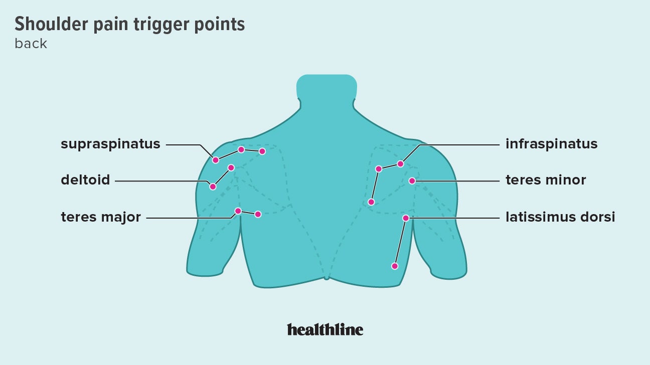 Frozen Shoulder Massage Trigger Points And 10 Recommended Stretches