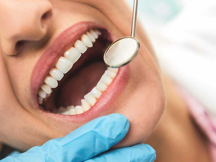 Enamel Erosion Causes Treatment And Prevention