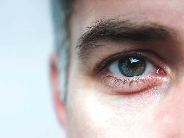 Mydriasis Causes Treatment And More Mydriasis Causes Treatment And More