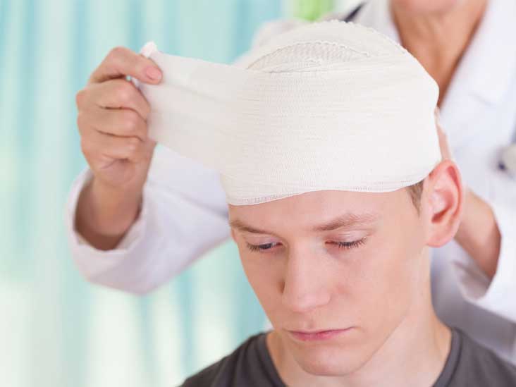 Battle Sign: Pictures, Causes, Treatment, and More