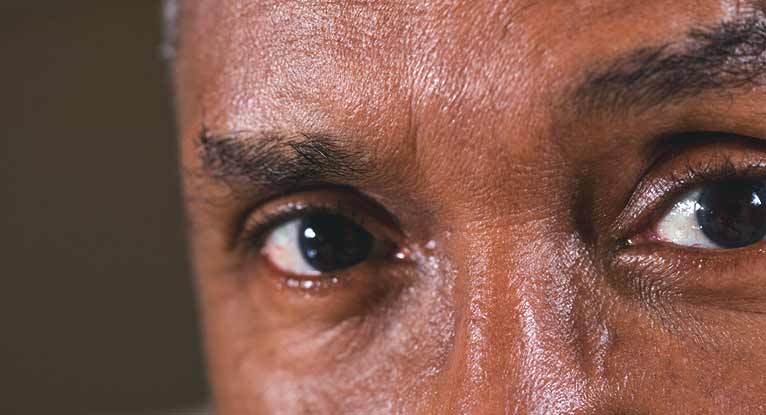 Eye Stroke Symptoms Causes And More Eye Stroke Symptoms Causes And More