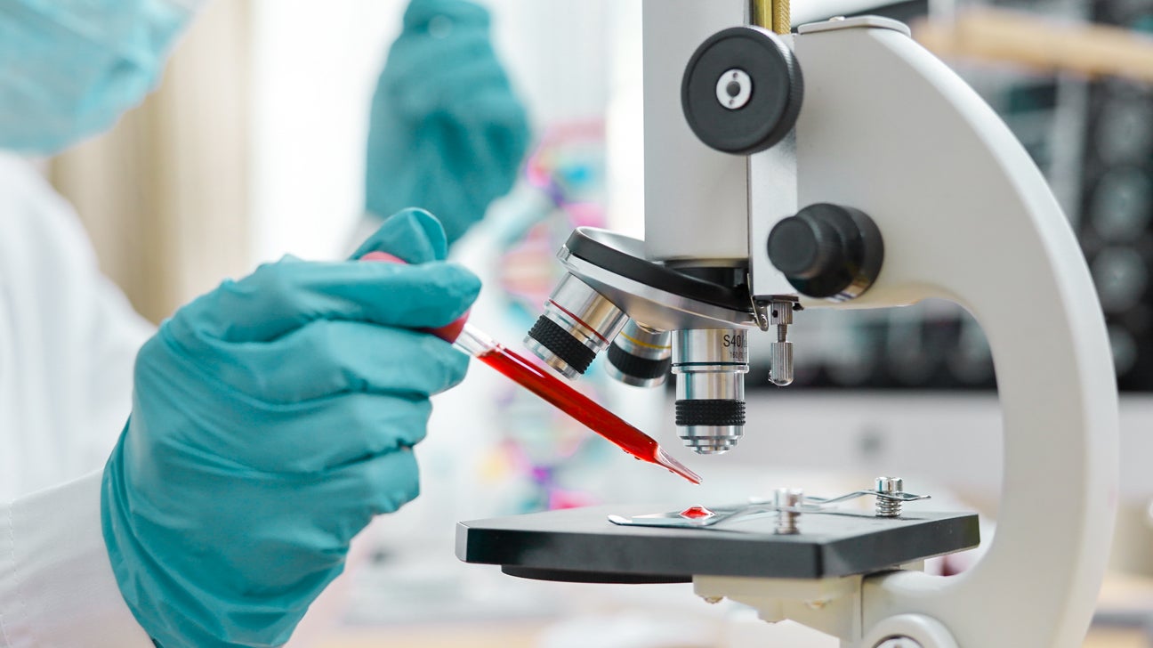 Hepatitis C (HCV) Genotype: Your Questions Answered