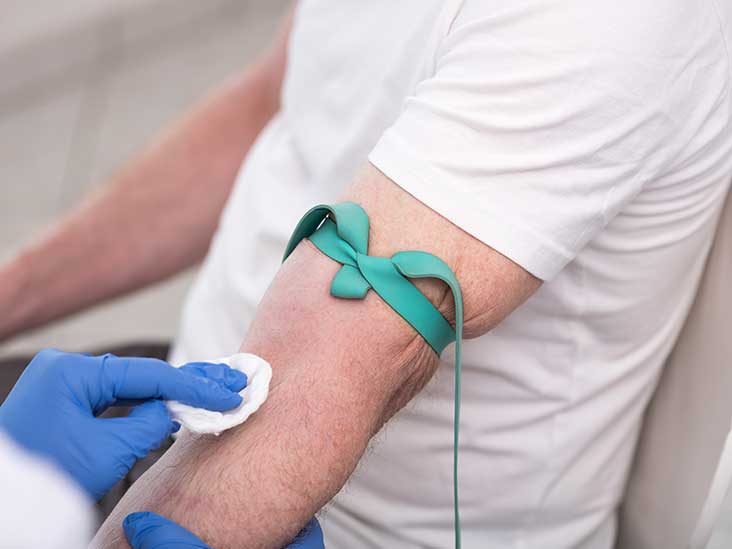 CMV Serology Test: Purpose, Procedure, and Risks