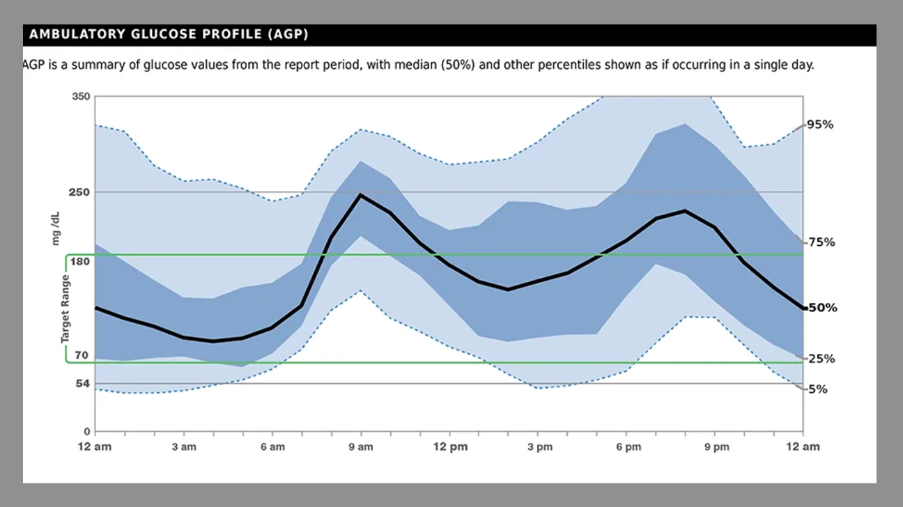What is the Ambulatory Glucose Profile (AGP) for Diabetes?