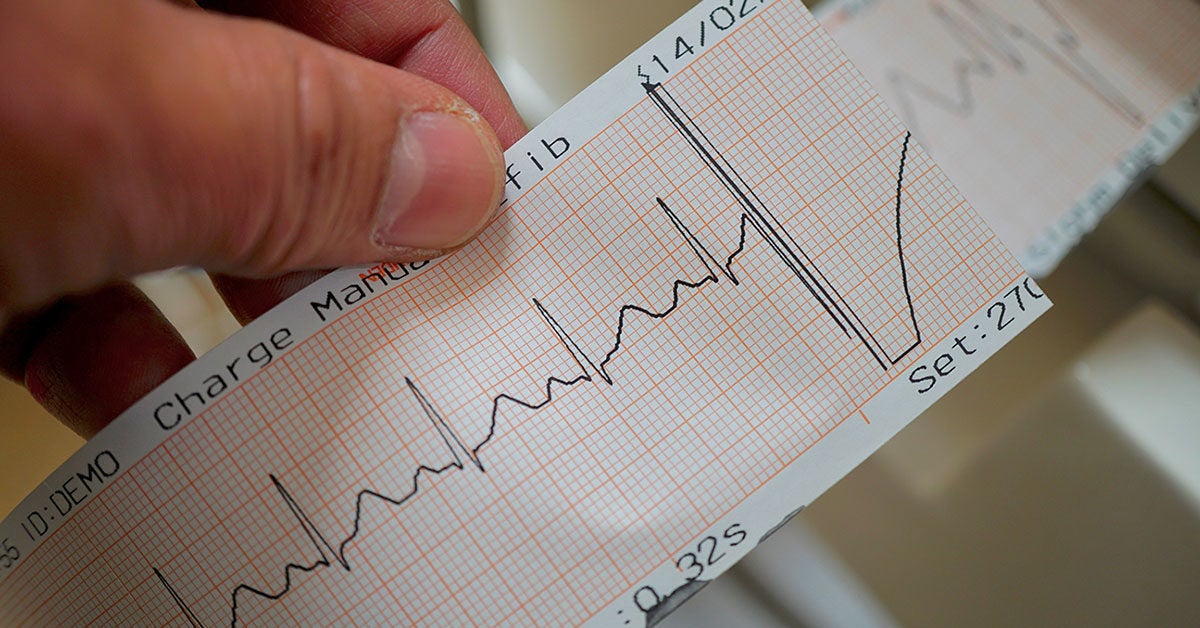 Septic Emboli: Causes, Diagnosis, and Treatment