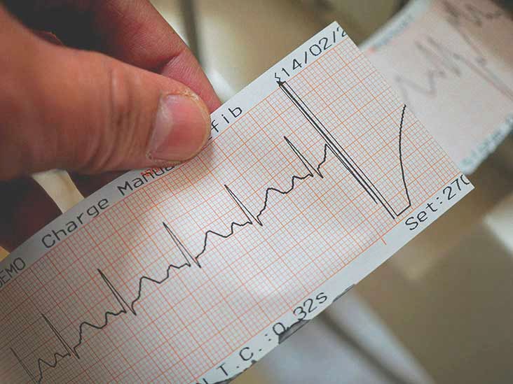 Septic Emboli: Causes, Diagnosis, and Treatment