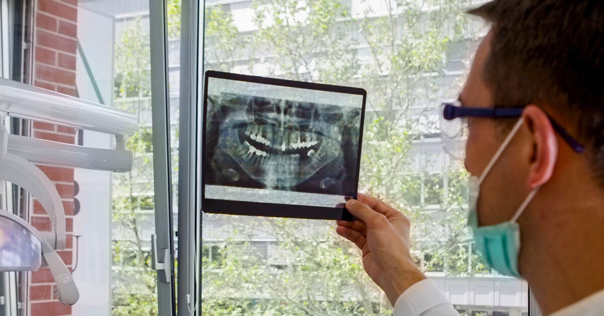 Recessed Maxilla (Upper Jawbone) Symptoms and How to Treat It