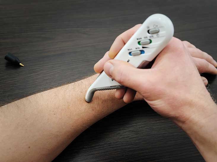 TENS Unit | Definition & Patient Education