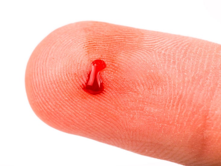 Bleeding Time Test Purpose Procedure And Risks