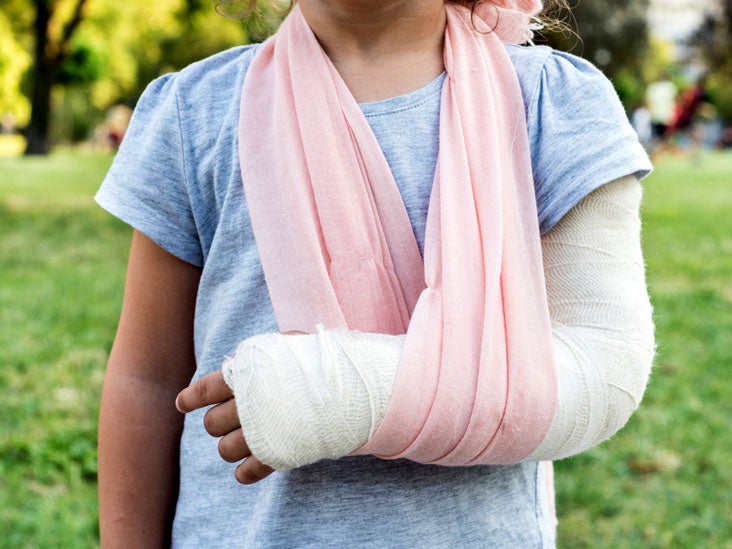 Bone Fracture Repair Procedure Preparation And Risks