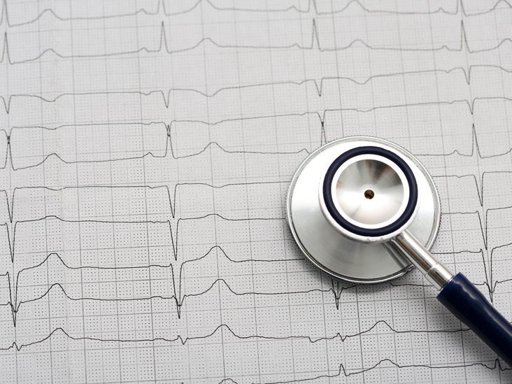 Electrocardiogram: Procedure, Risks & Results