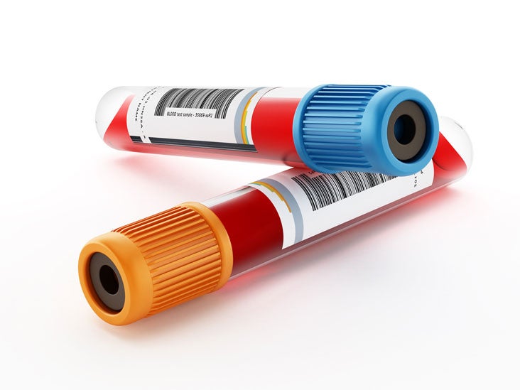 Partial Thromboplastin Time (PTT) Test: Purpose and Procedure