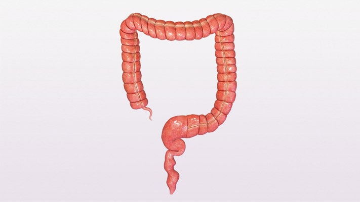 Some Tests For Colorectal Cancer Are Better Than Others some-tests-for-colorectal-cancer-are-better-than-others