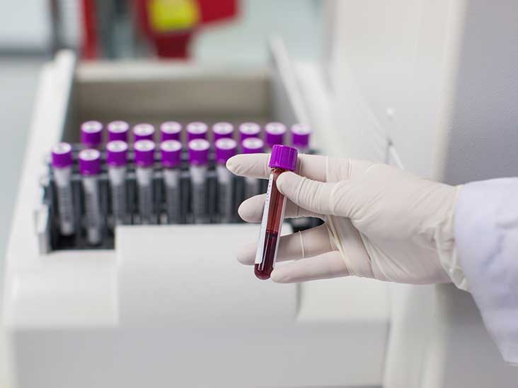 Testing for Metastatic Renal Cell Carcinoma