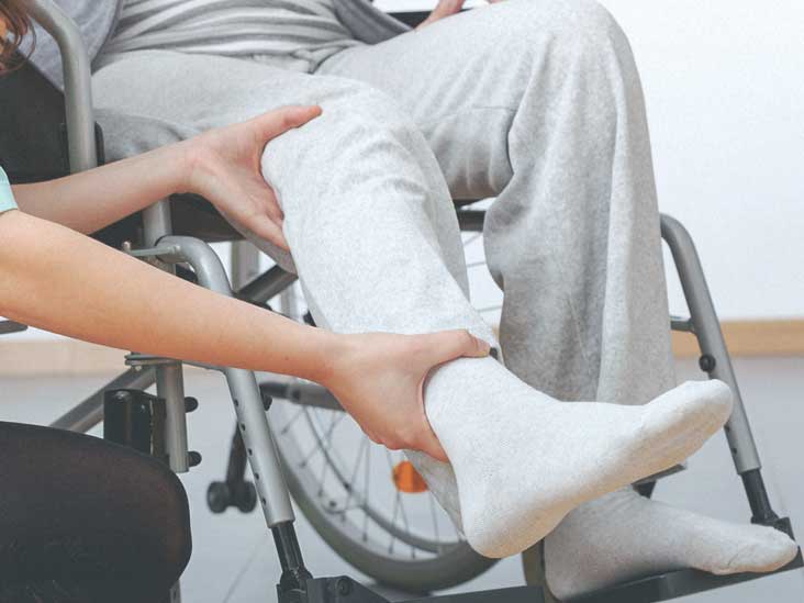 Dependent Edema Definition Symptoms Pitting And Non Pitting