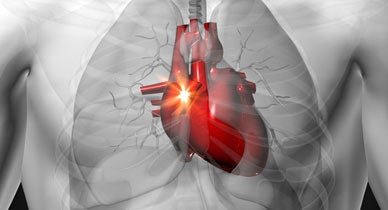 Hyperlipoproteinemia: Types, Symptoms, and Treatments