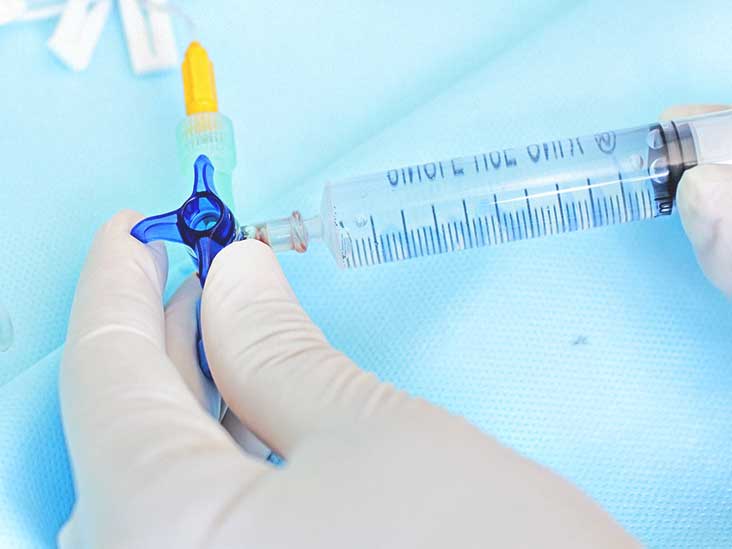 Ommaya Reservoir: Placement, Removal, Safety, and Complications