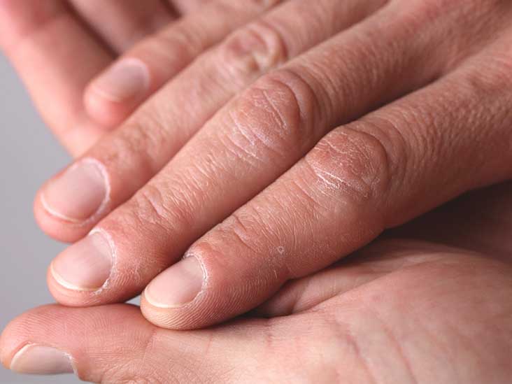 Ridges In Fingernails Symptoms Causes And Treatments