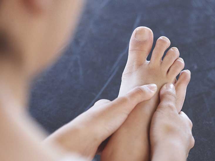Plantar Fibroma: Symptoms, Treatment, and More