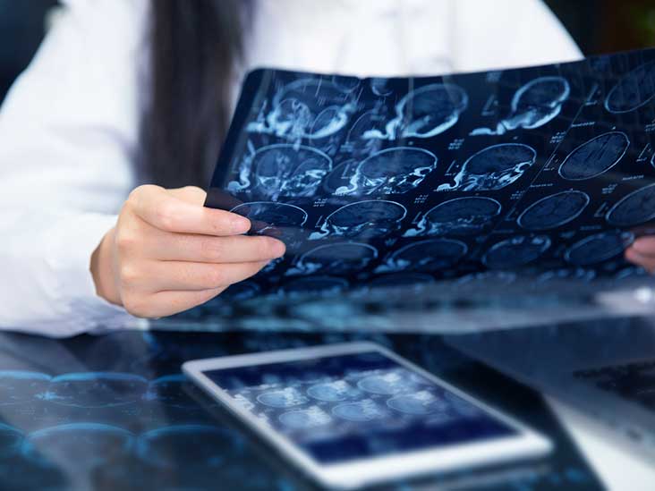 RRMS and PPMS: Differences in Symptoms, Treatment & More