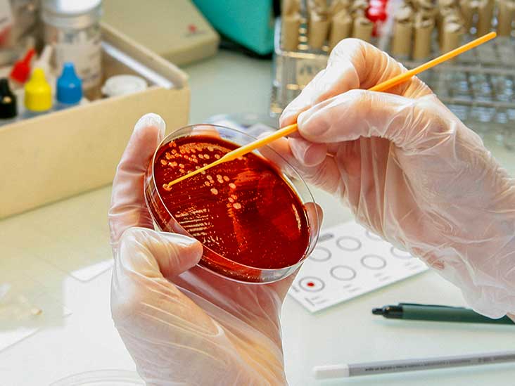 Staphylococcal Meningitis: Risk Factors, Causes, and Diagnosis