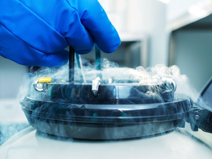 Cervix Treatment Cryosurgery: Purpose, Procedure, and Risks