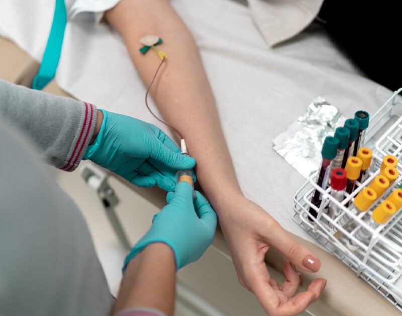 Aspergillus Precipitin Test: Preparation, Risks, and Results