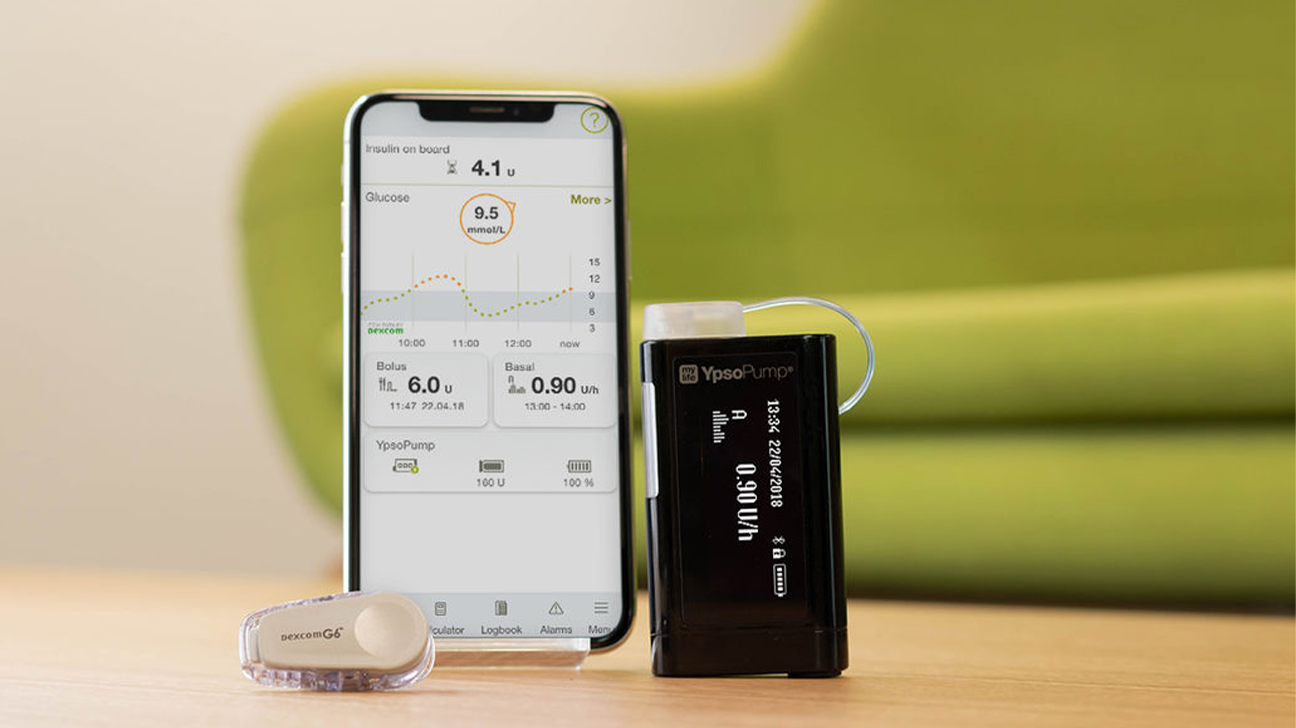 Is there an Automated Insulin Delivery System?