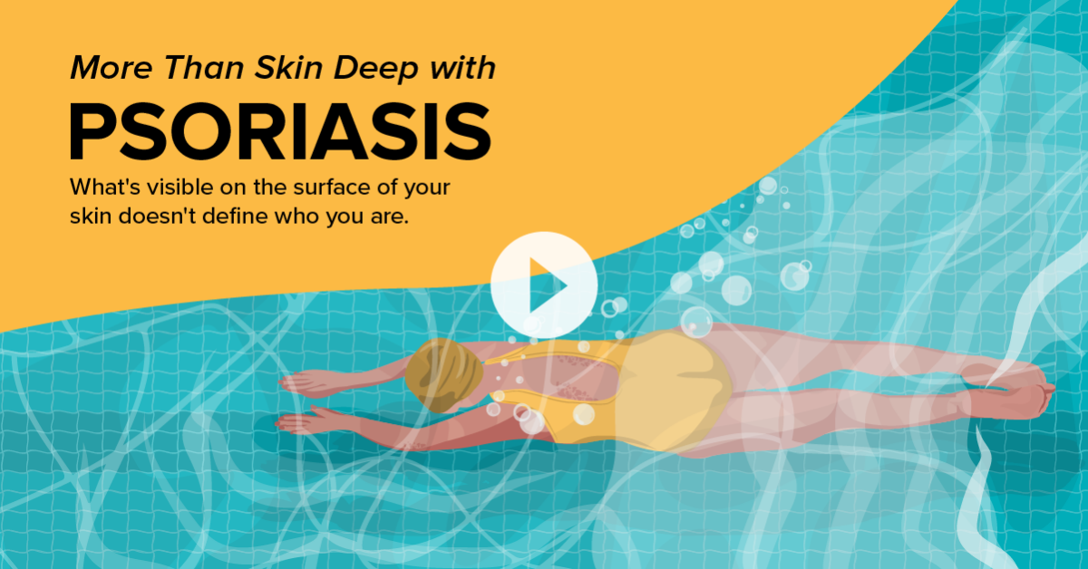Psoriasis Video Stories and Information from Healthline