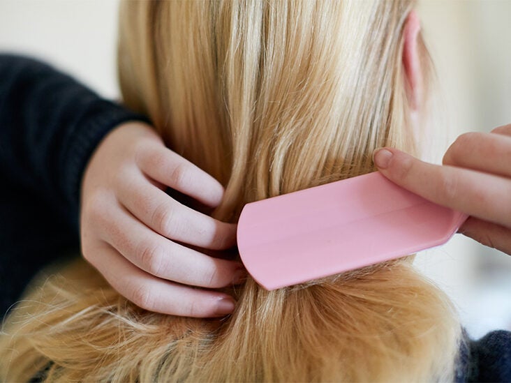 18 Hair Loss Calculator KirstieLetisha