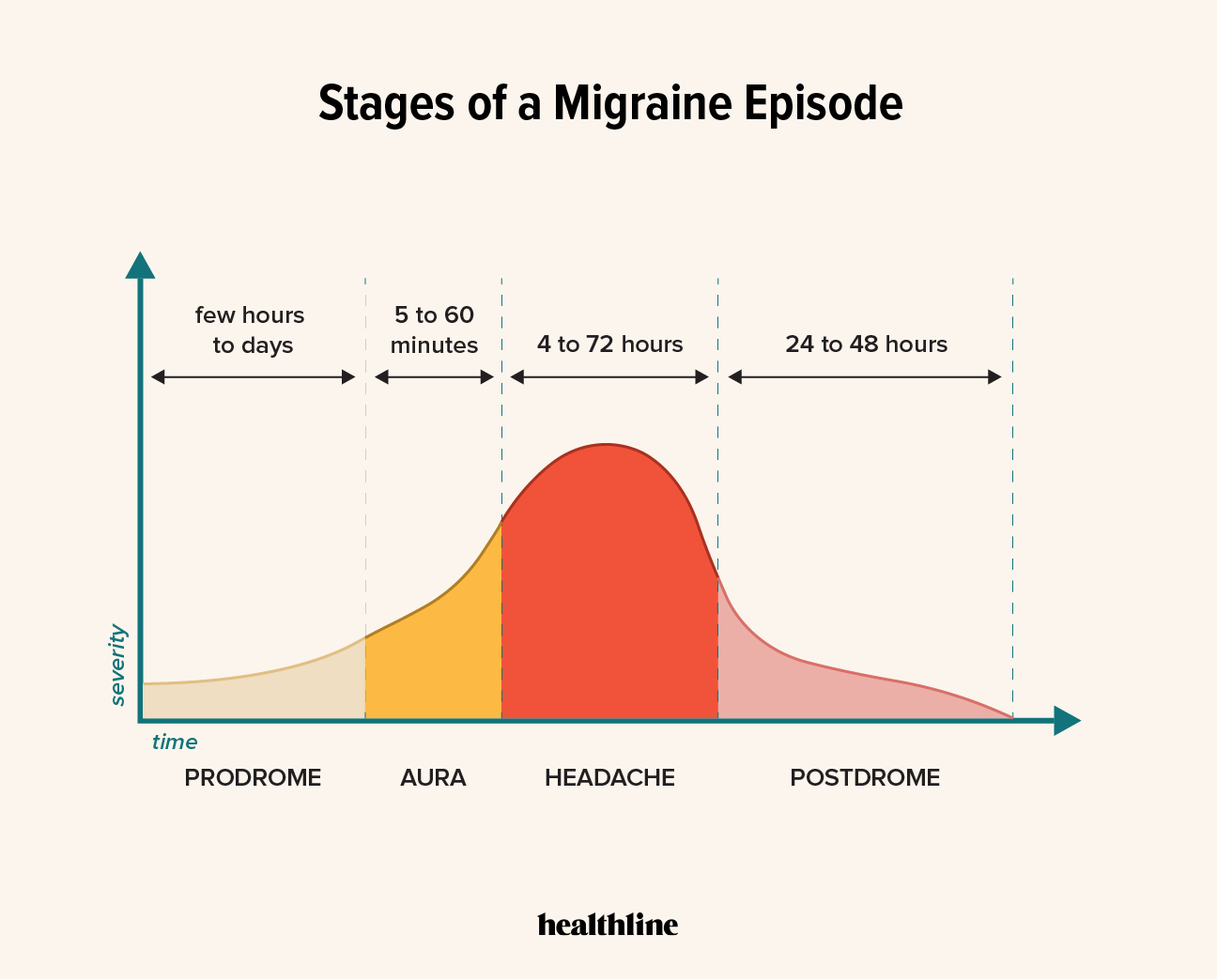Migraine Stages And Timeline Symptoms Treatment By Stage